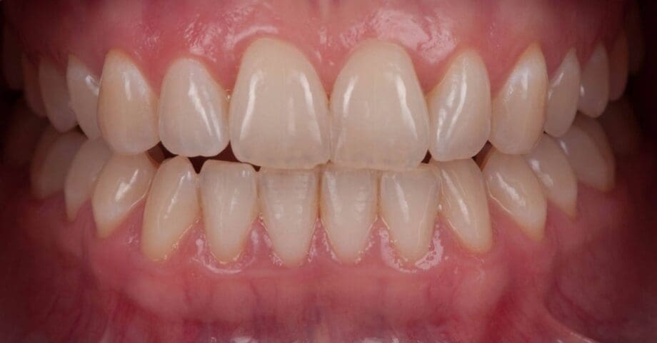 All About Your 32 Pearls - Teeth Names and Functions | 32 Pearls